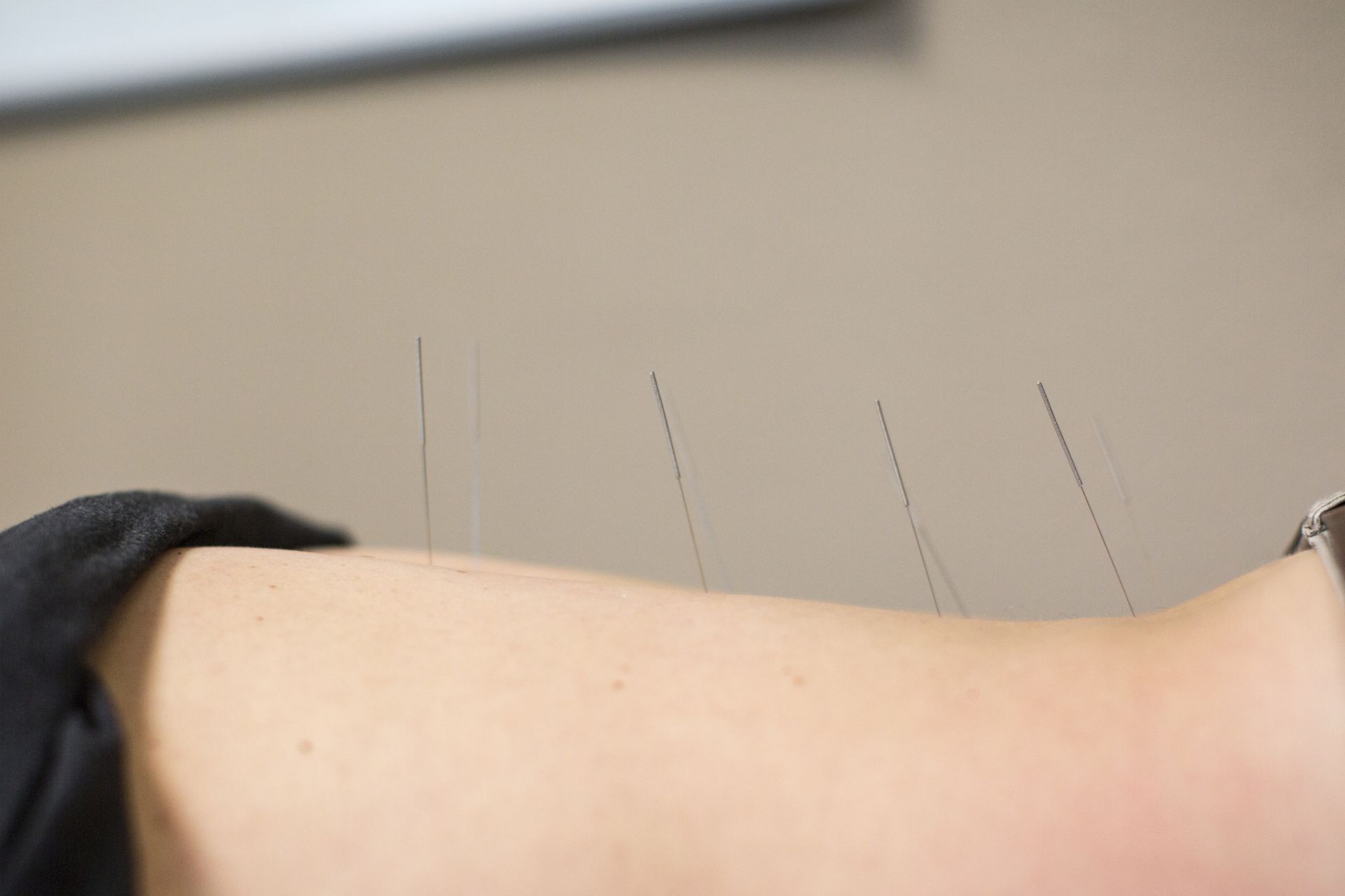 Physio – Room